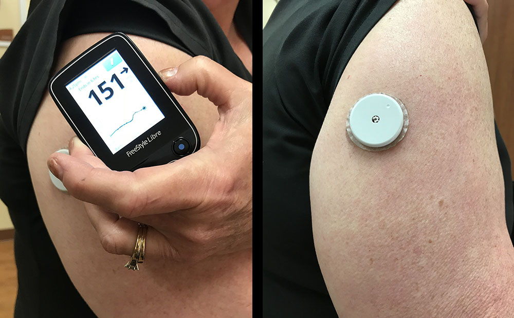 Have You Seen This? (The Freestyle Libre System) - Caroline Fife M.D.