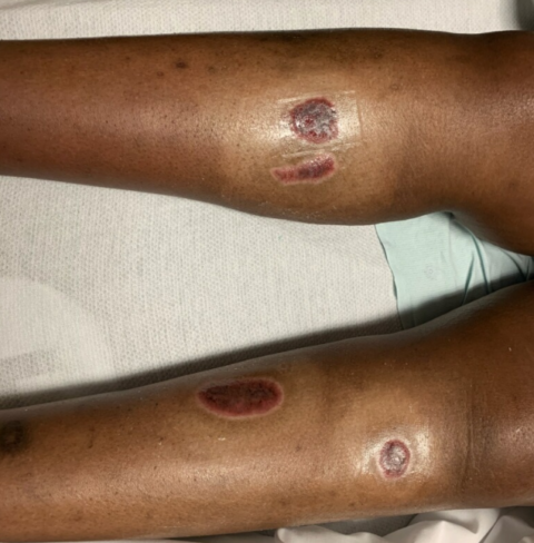 UPDATE: Wounds are a SYMPTOM – What’s the Diagnosis? Crowdsourcing ...